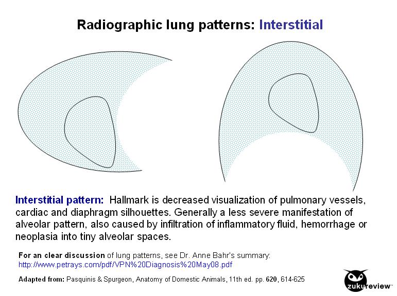 2. Interstitial pattern , characterized by decreased visualization of ...
