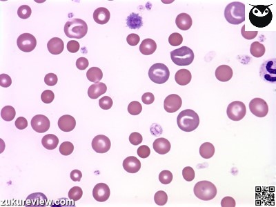 NAVLE® Question of the Day Friday, Jul 5th, 2024 | Zuku Review